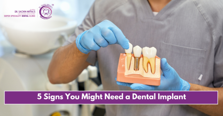 5 Signs You Might Need a Dental Implant - Dr. Sachin Mittal : Dentist ...